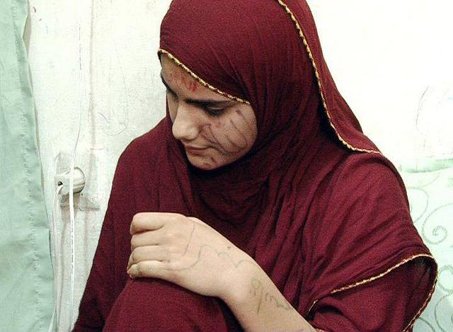 Name of Allah sacred on a girl skin – Pajhwok Afghan News